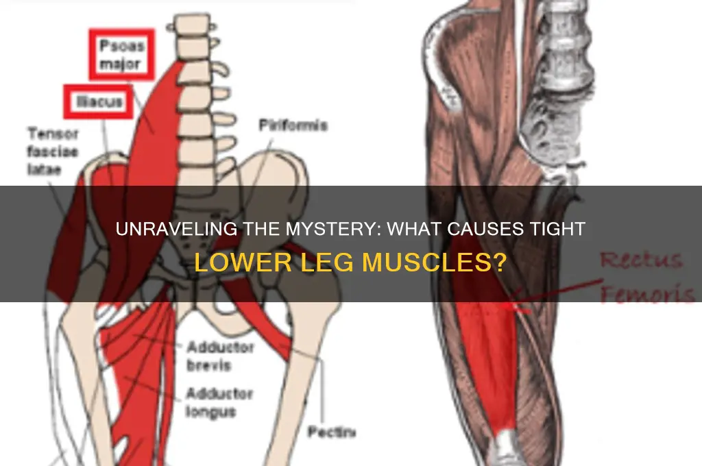 Unraveling The Mystery: What Causes Tight Lower Leg Muscles? | CyVigor