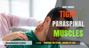 Understanding Tight Rib Muscles: Causes, Symptoms, And Relief ...