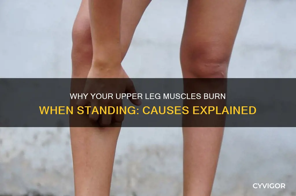 Why Your Upper Leg Muscles Burn When Standing: Causes Explained | CyVigor