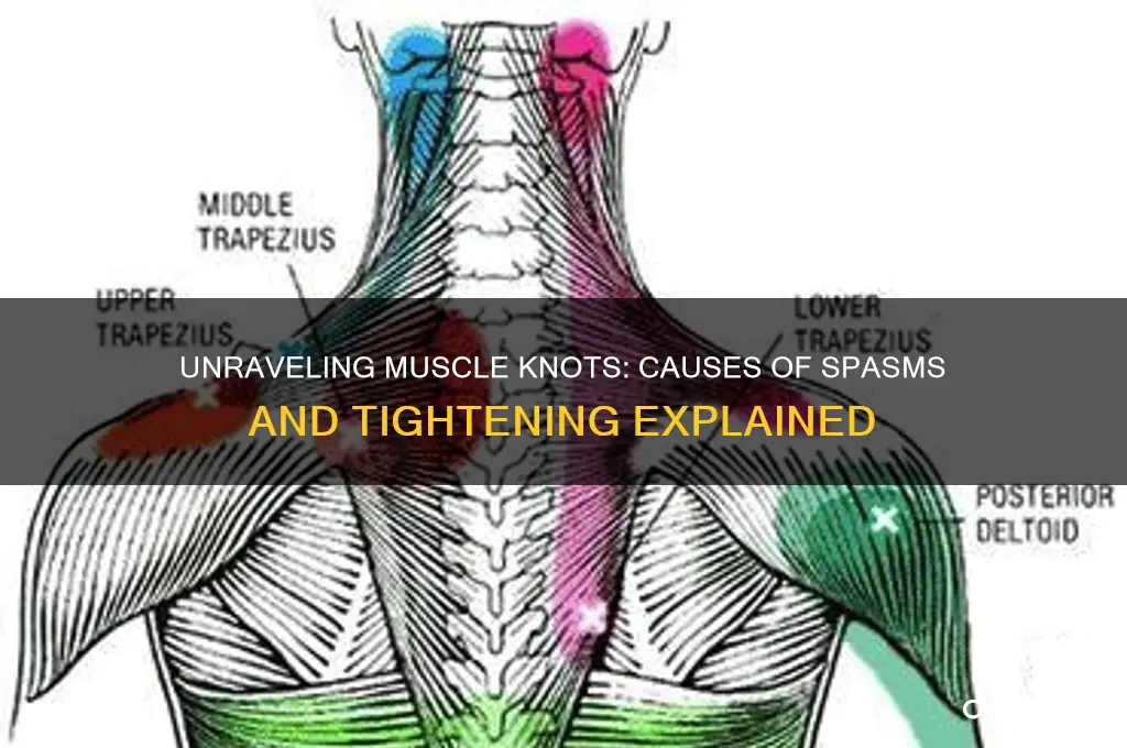 Unraveling Muscle Knots: Causes Of Spasms And Tightening Explained ...