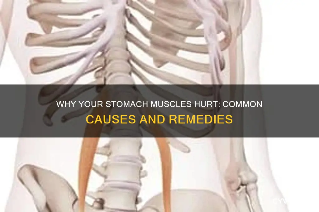 Why Your Stomach Muscles Hurt: Common Causes And Remedies | CyVigor