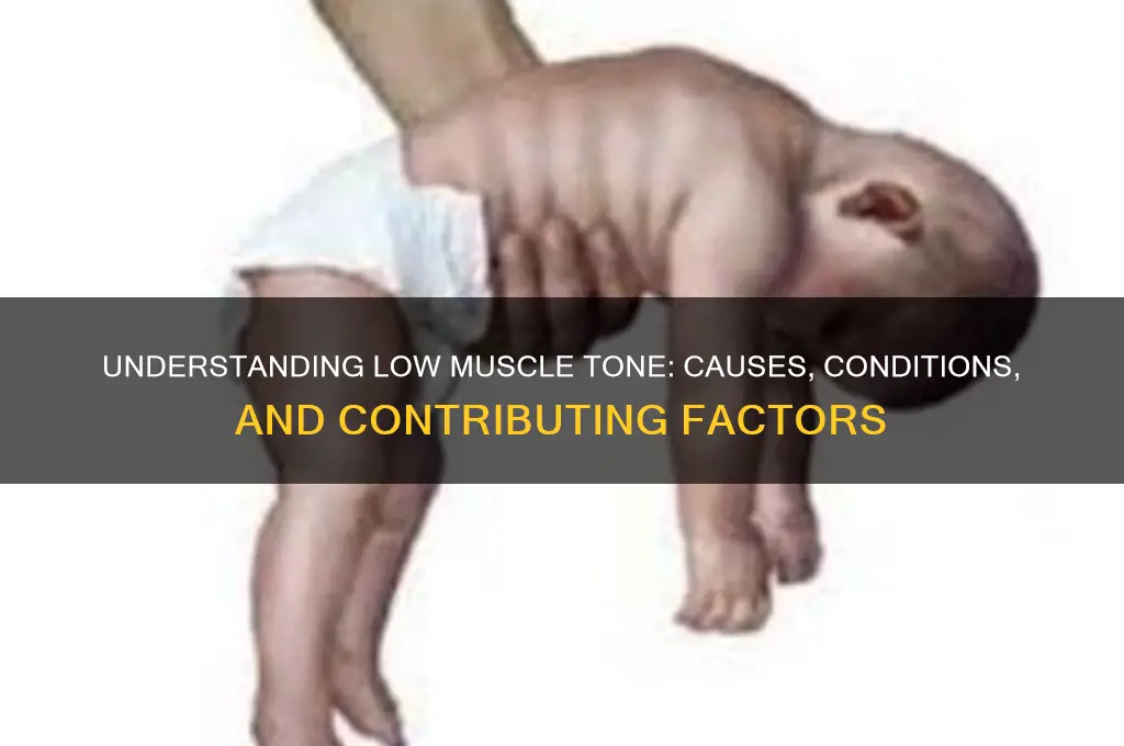 Understanding Low Muscle Tone: Causes, Conditions, And Contributing ...
