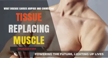 Understanding Myositis Ossificans: The Disease That Turns Muscle Into ...