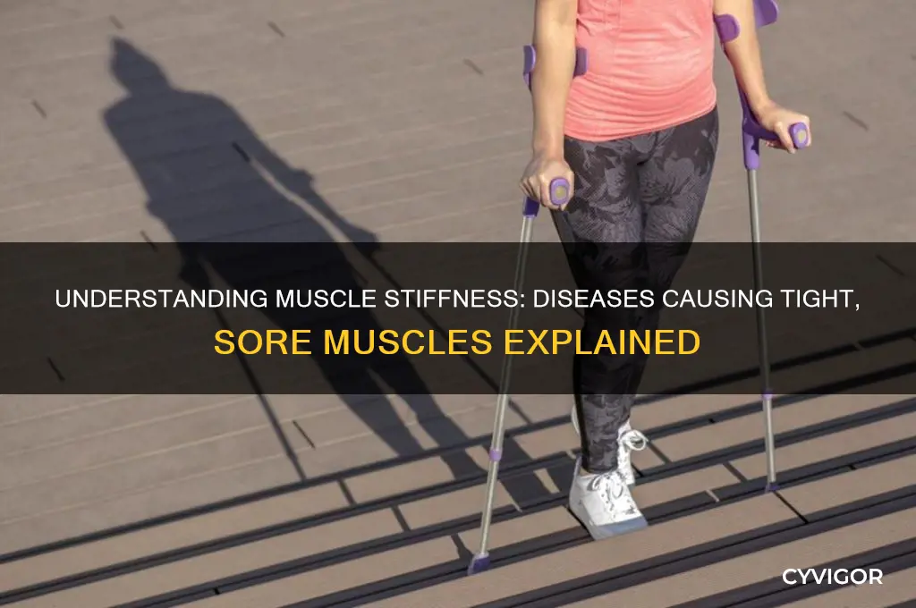Understanding Muscle Stiffness: Diseases Causing Tight, Sore Muscles ...