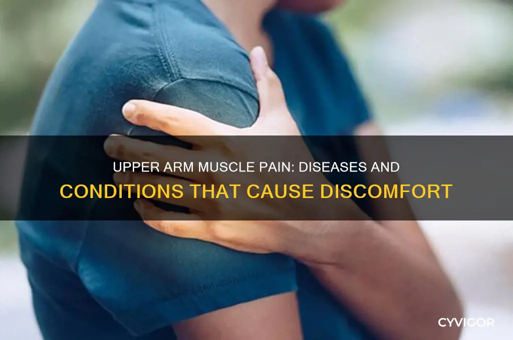 Upper Arm Muscle Pain: Diseases And Conditions That Cause Discomfort ...