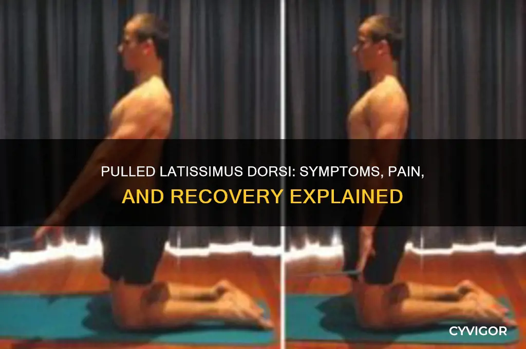 Pulled Latissimus Dorsi: Symptoms, Pain, And Recovery Explained | CyVigor