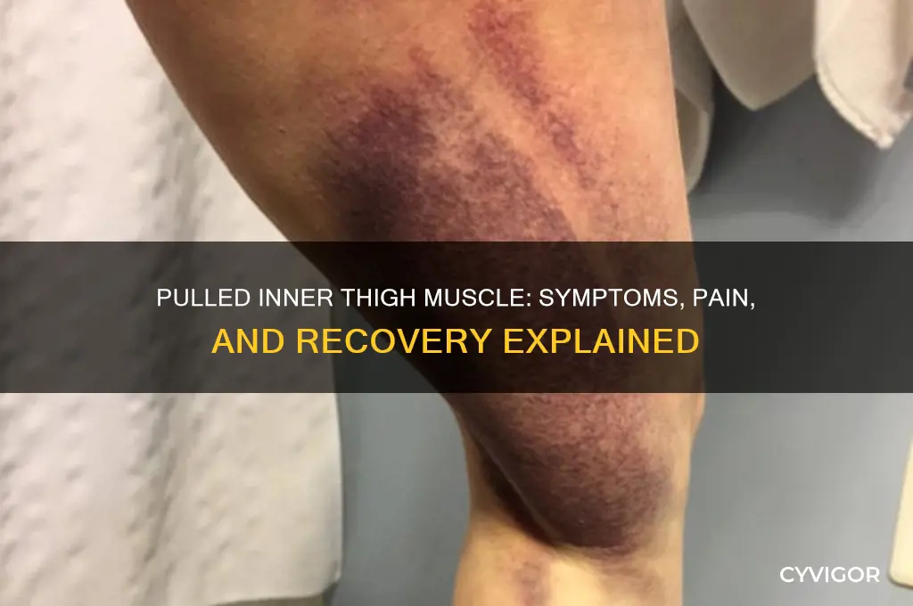 Pulled Inner Thigh Muscle: Symptoms, Pain, And Recovery Explained | CyVigor