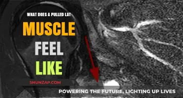 Pulled Wrist Muscle: Symptoms, Pain, And Recovery Explained | CyVigor