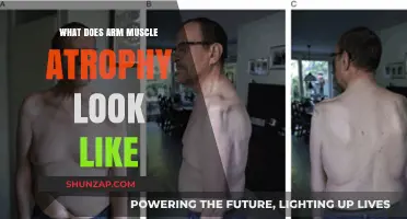 Understanding The Moment Arm: Muscle Mechanics And Leverage Explained ...