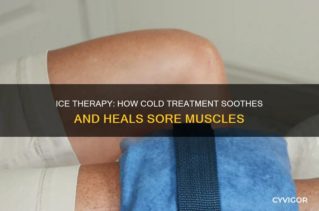 Ice Therapy: How Cold Treatment Soothes And Heals Sore Muscles | CyVigor