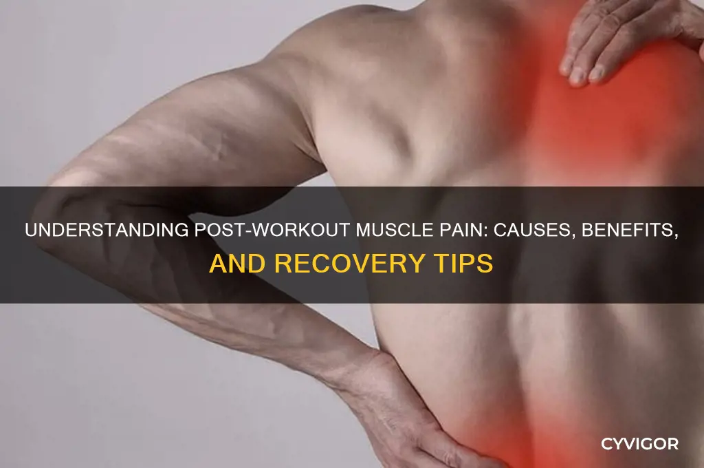 Understanding Post-Workout Muscle Pain: Causes, Benefits, And Recovery ...