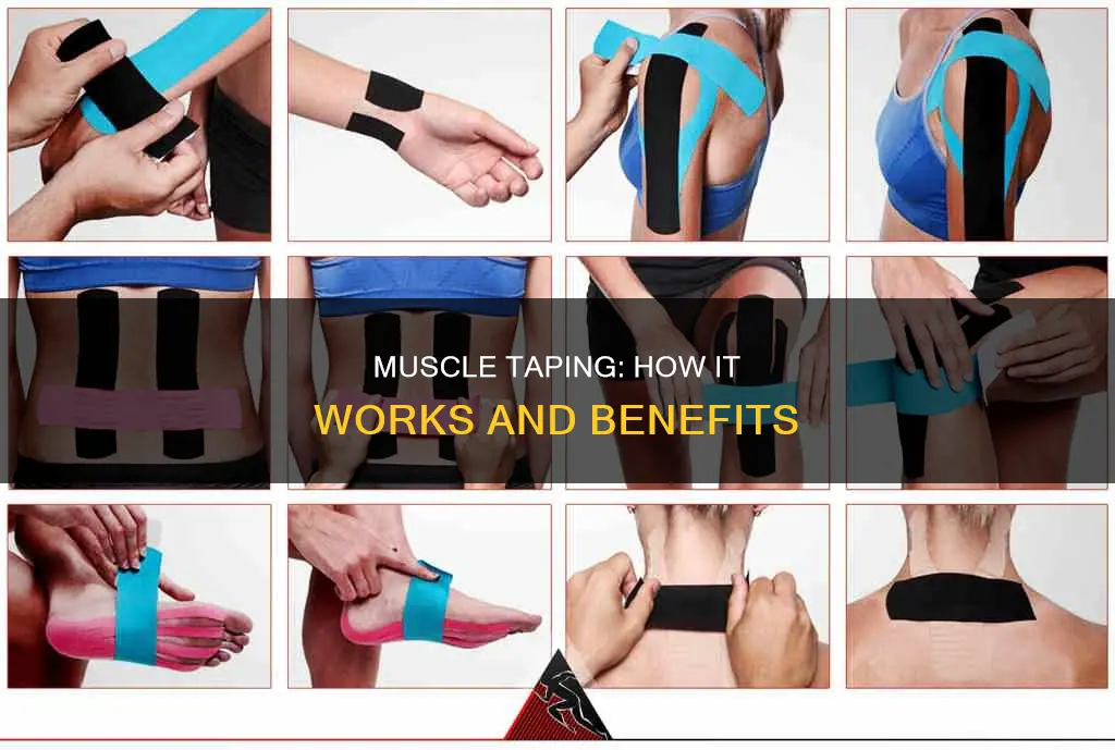 Muscle Taping: How It Works And Benefits | CyVigor