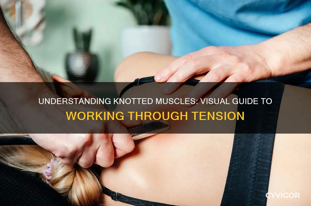 Understanding Knotted Muscles: Visual Guide To Working Through Tension ...