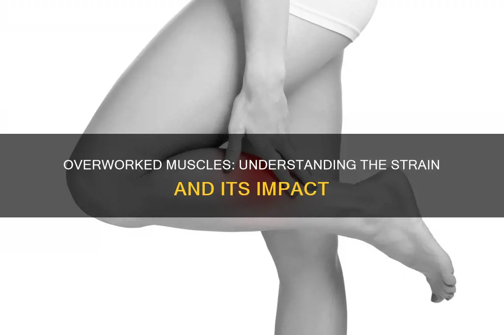 Overworked Muscles: Understanding The Strain And Its Impact | CyVigor