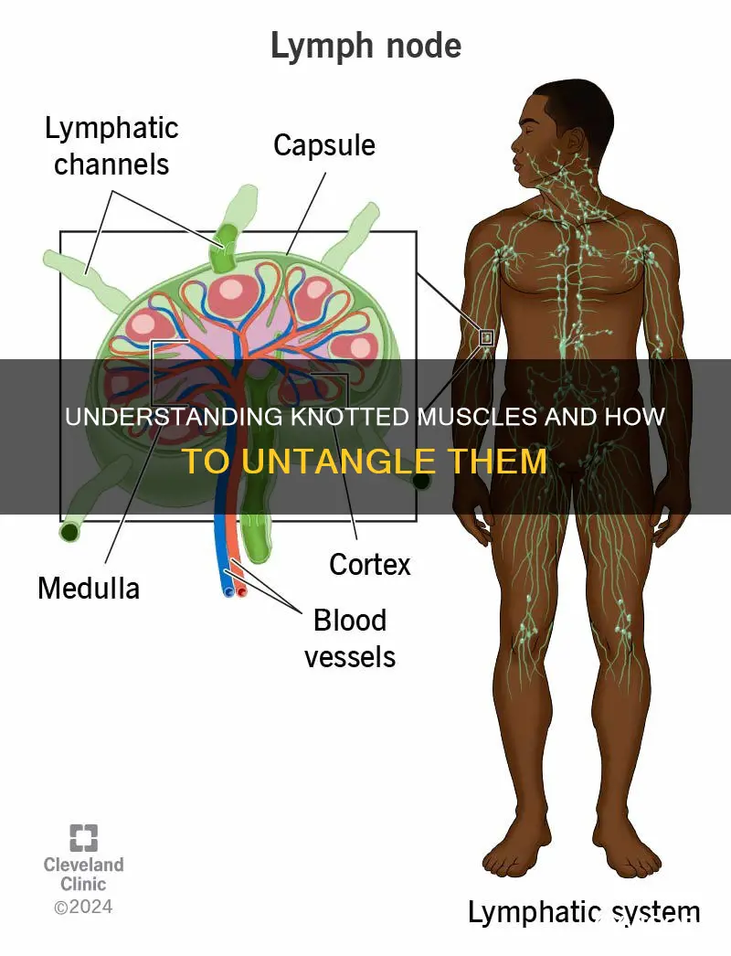 Understanding Knotted Muscles And How To Untangle Them | CyVigor