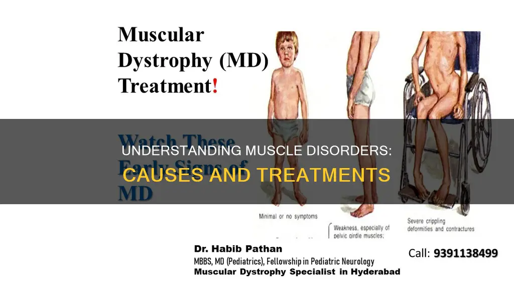 Understanding Muscle Disorders: Causes And Treatments | CyVigor
