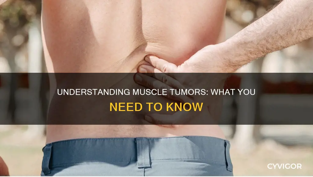 Understanding Muscle Tumors: What You Need To Know | CyVigor