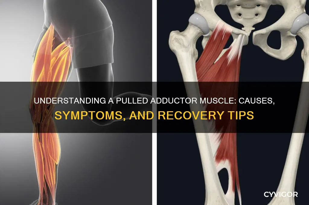 Understanding A Pulled Adductor Muscle: Causes, Symptoms, And Recovery ...