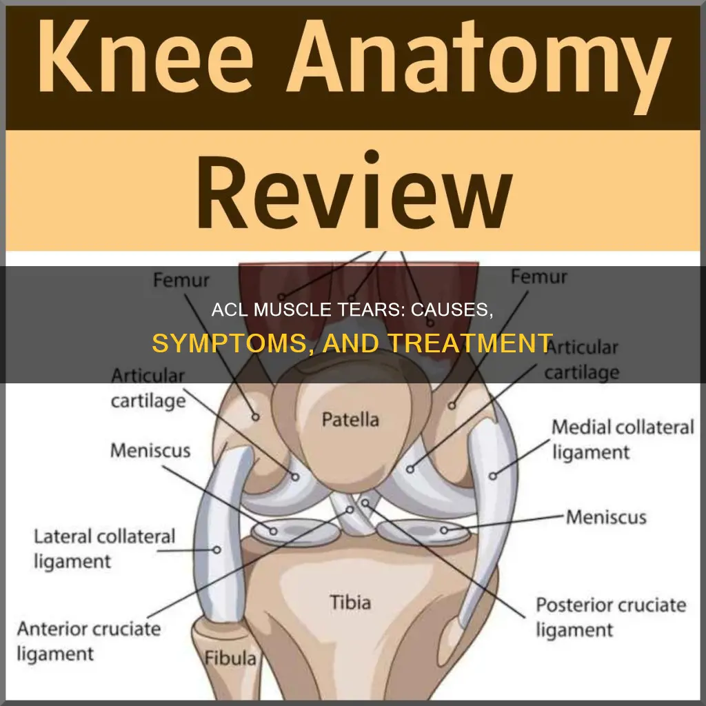Acl Muscle Tears: Causes, Symptoms, And Treatment | CyVigor