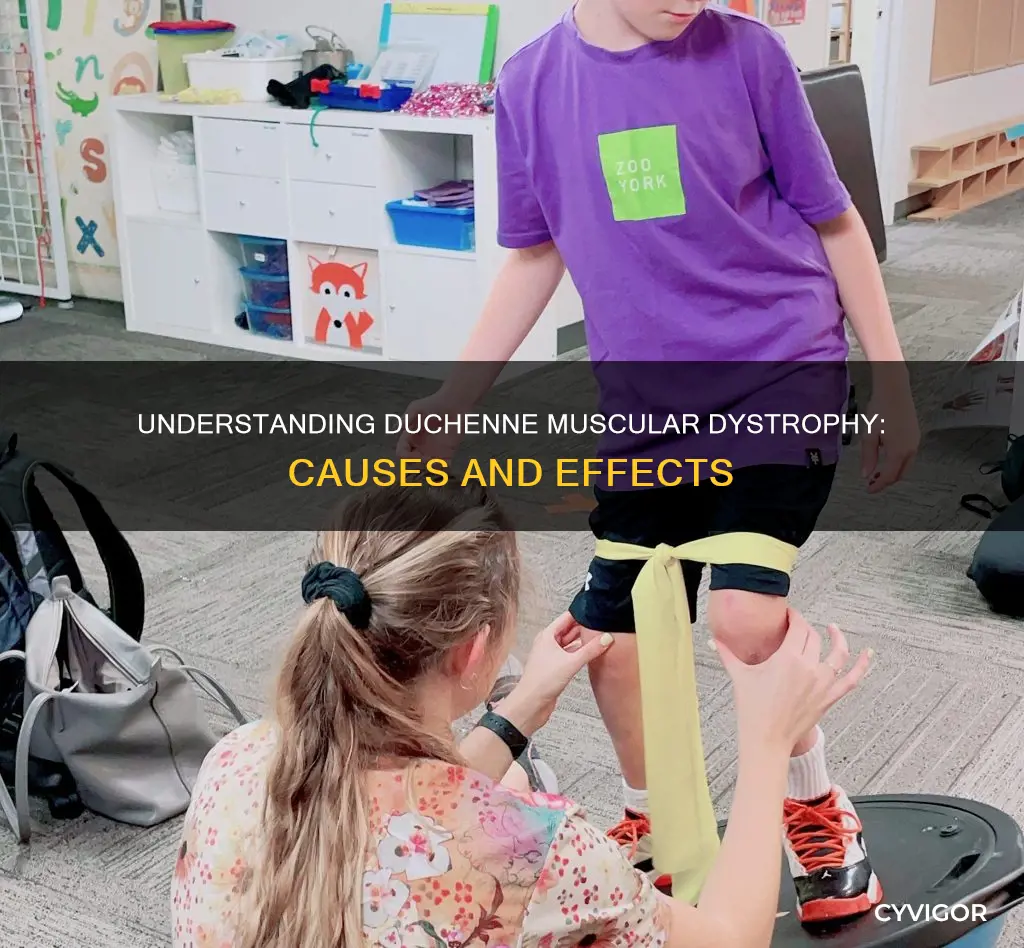 Understanding Duchenne Muscular Dystrophy: Causes And Effects | CyVigor