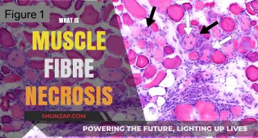 Understanding Muscle Fasciculation And Succinylcholine | CyVigor