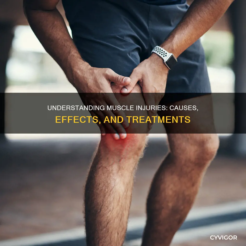 Understanding Muscle Injuries: Causes, Effects, And Treatments | CyVigor