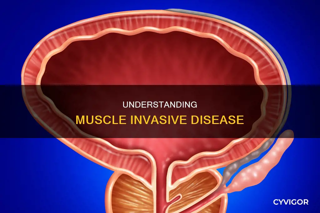Understanding Muscle Invasive Disease | CyVigor
