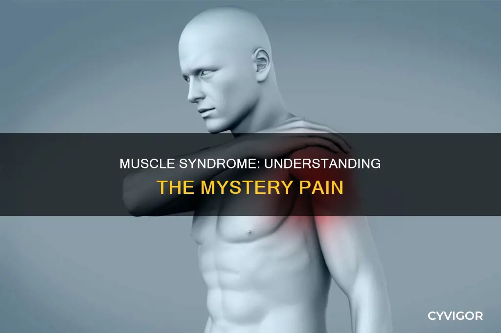 Muscle Syndrome: Understanding The Mystery Pain | CyVigor