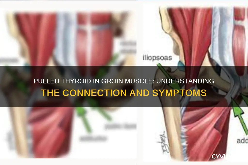 Pulled Thyroid In Groin Muscle: Understanding The Connection And ...