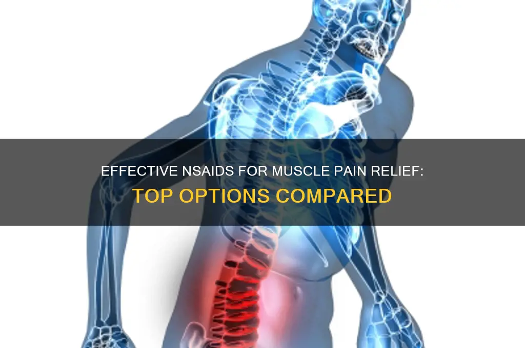 Effective Nsaids For Muscle Pain Relief: Top Options Compared | CyVigor