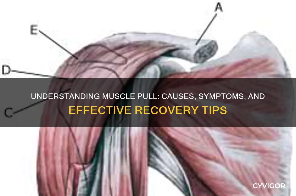 Understanding Muscle Pull: Causes, Symptoms, And Effective Recovery ...