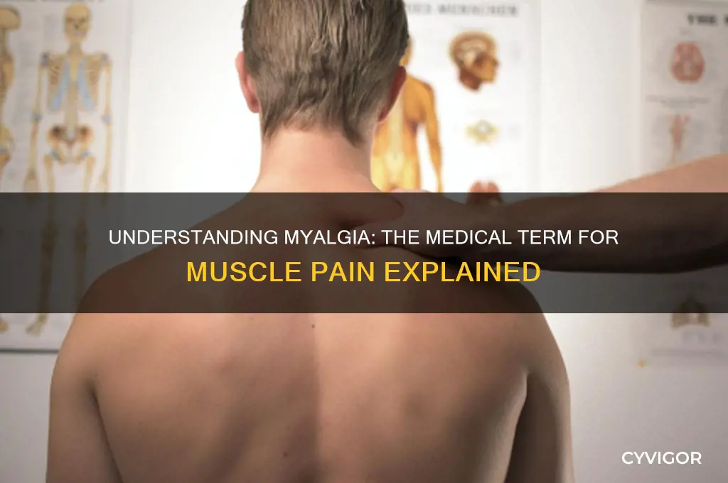 Understanding Myalgia: The Medical Term For Muscle Pain Explained | CyVigor