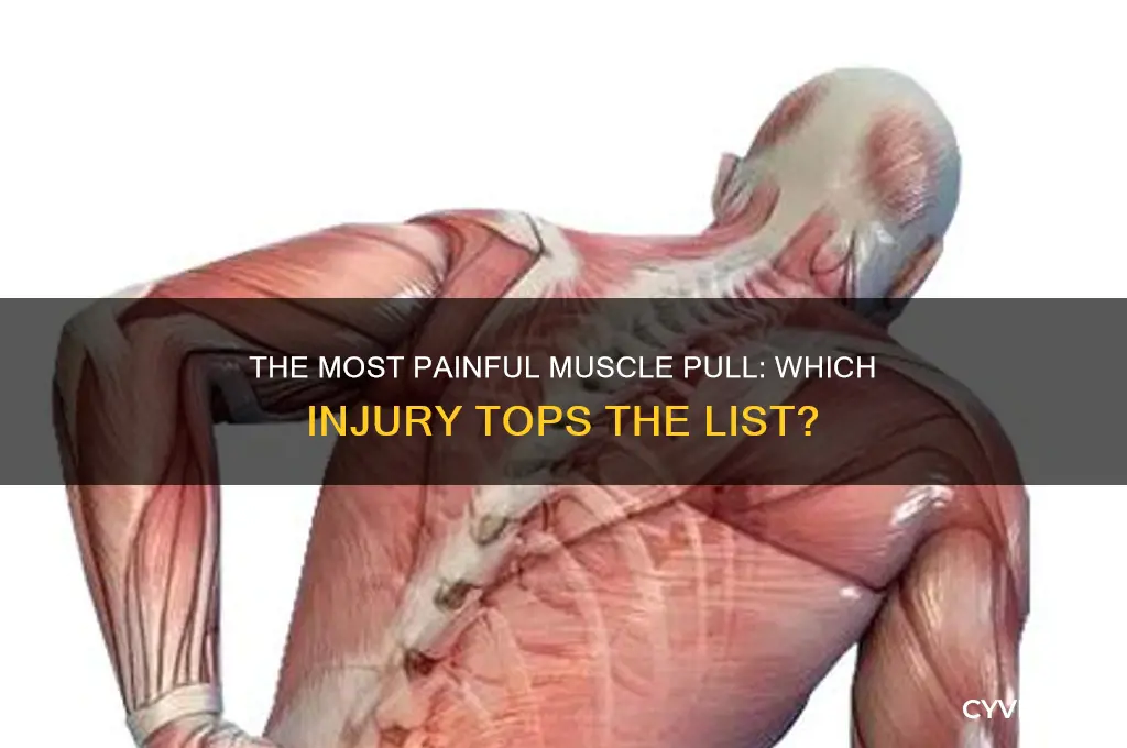The Most Painful Muscle Pull: Which Injury Tops The List? | CyVigor