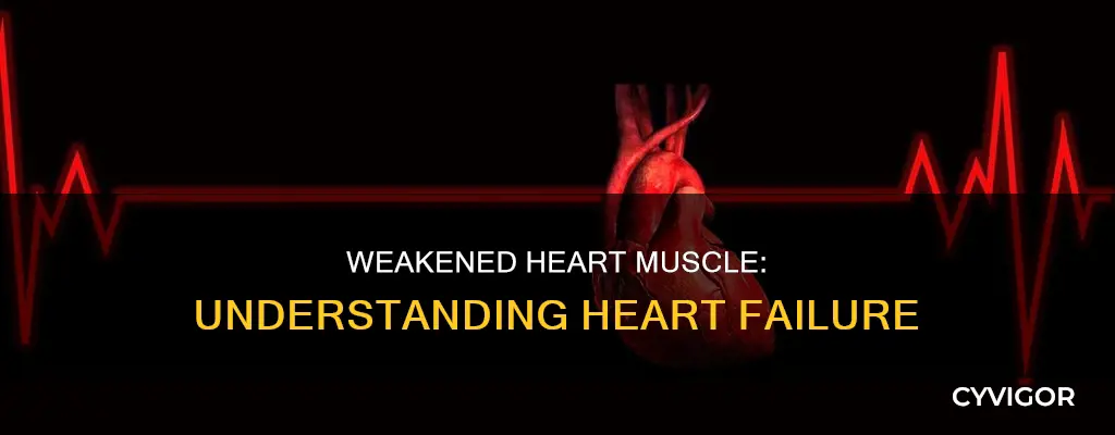 Weakened Heart Muscle: Understanding Heart Failure | CyVigor
