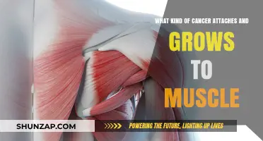 Why Flu Triggers Muscle Aches: Understanding The Painful Connection ...