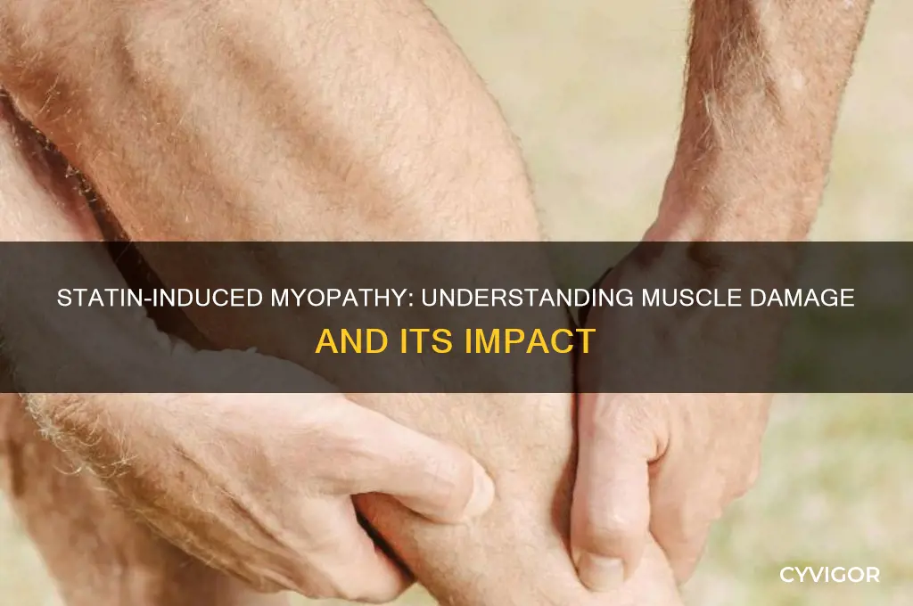 Statin-Induced Myopathy: Understanding Muscle Damage And Its Impact ...