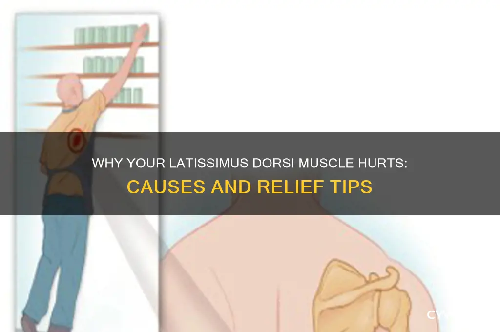 Why Your Latissimus Dorsi Muscle Hurts: Causes And Relief Tips | CyVigor