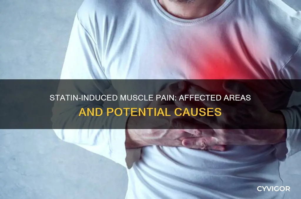 Statin-Induced Muscle Pain: Affected Areas And Potential Causes | CyVigor