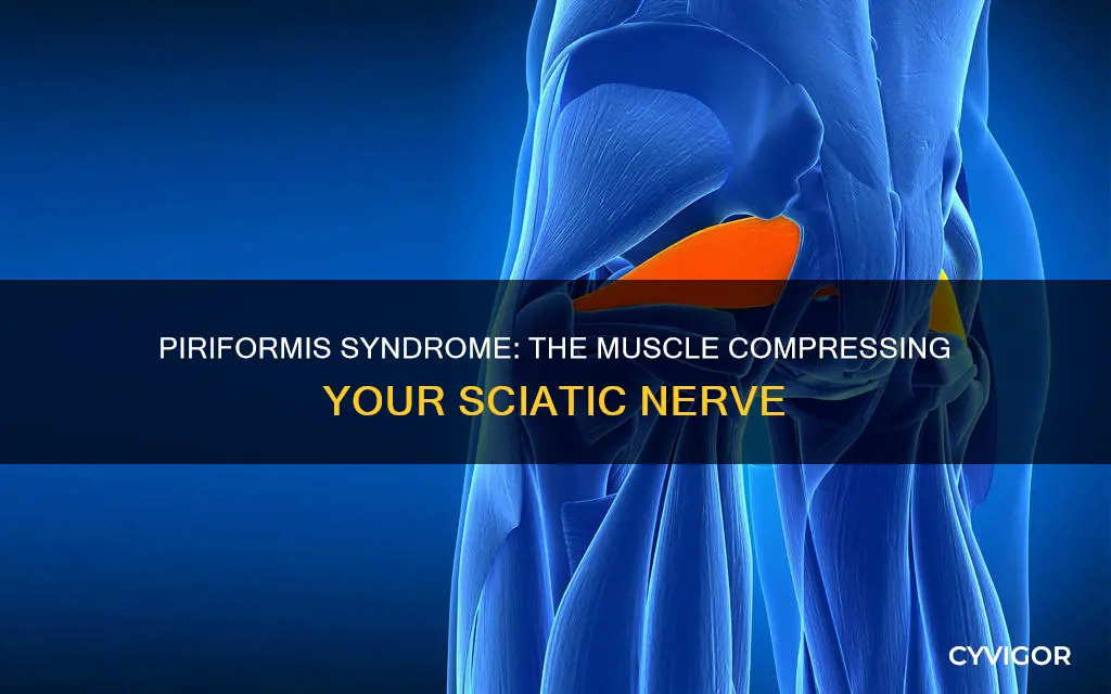 Piriformis Syndrome: The Muscle Compressing Your Sciatic Nerve | CyVigor
