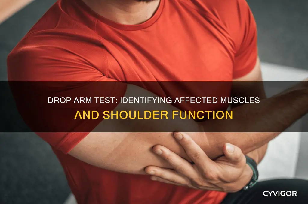 Drop Arm Test: Identifying Affected Muscles And Shoulder Function | CyVigor