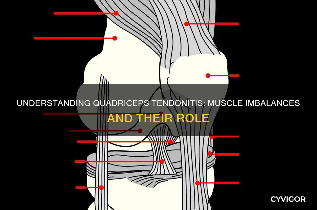 Understanding Quadriceps Tendonitis: Muscle Imbalances And Their Role ...