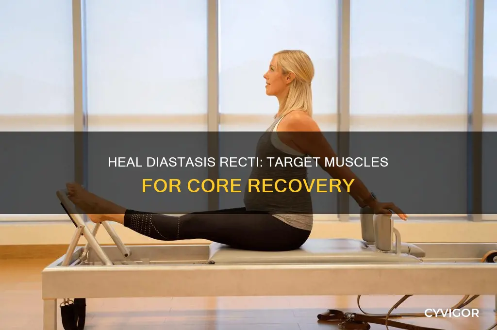Heal Diastasis Recti: Target Muscles For Core Recovery | CyVigor
