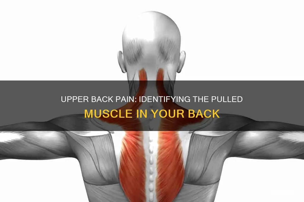 Upper Back Pain: Identifying The Pulled Muscle In Your Back | CyVigor
