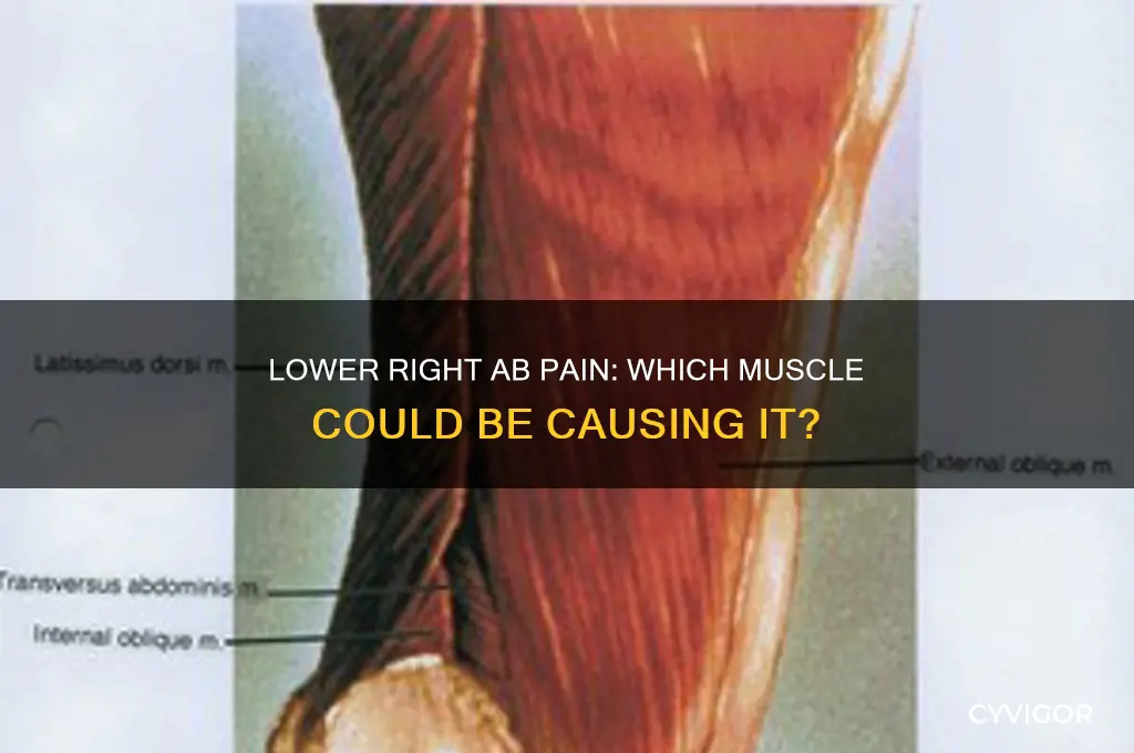 Lower Right Ab Pain: Which Muscle Could Be Causing It? | CyVigor