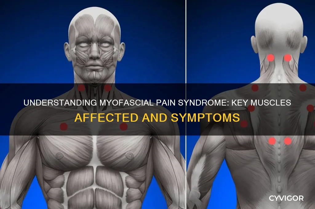 Understanding Myofascial Pain Syndrome: Key Muscles Affected And ...