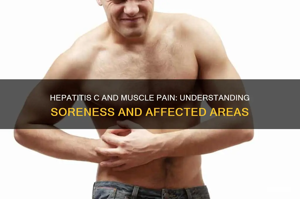 Hepatitis C And Muscle Pain: Understanding Soreness And Affected Areas ...