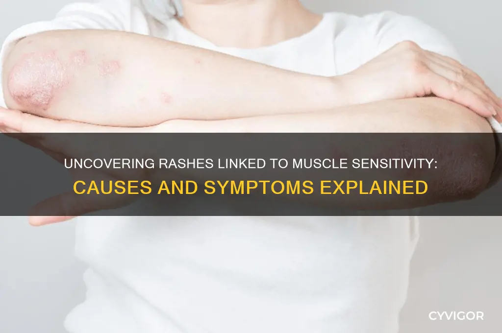 Uncovering Rashes Linked To Muscle Sensitivity: Causes And Symptoms ...