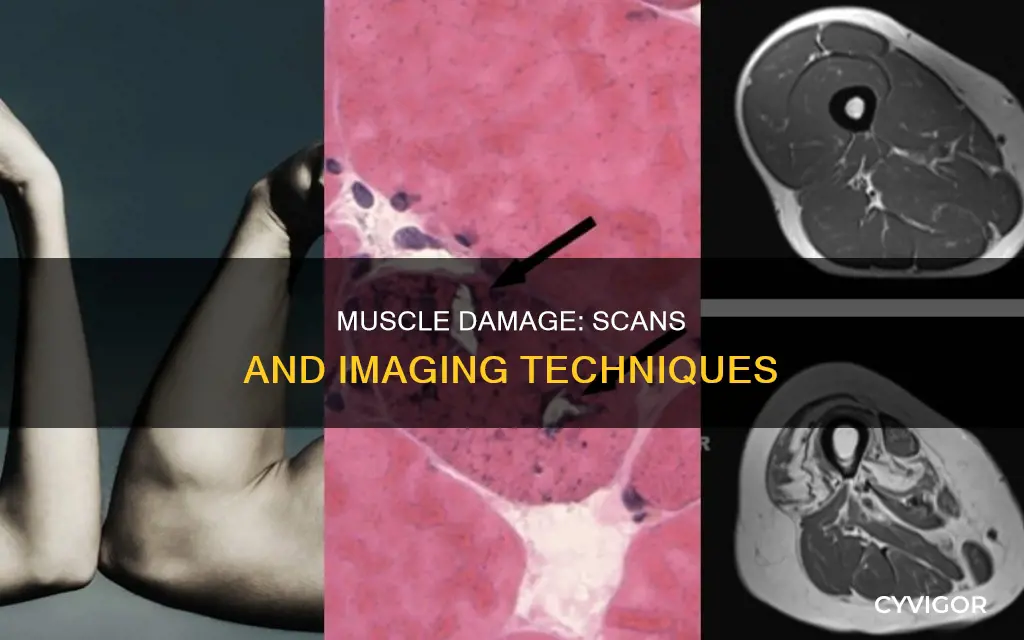 Muscle Damage: Scans And Imaging Techniques | CyVigor
