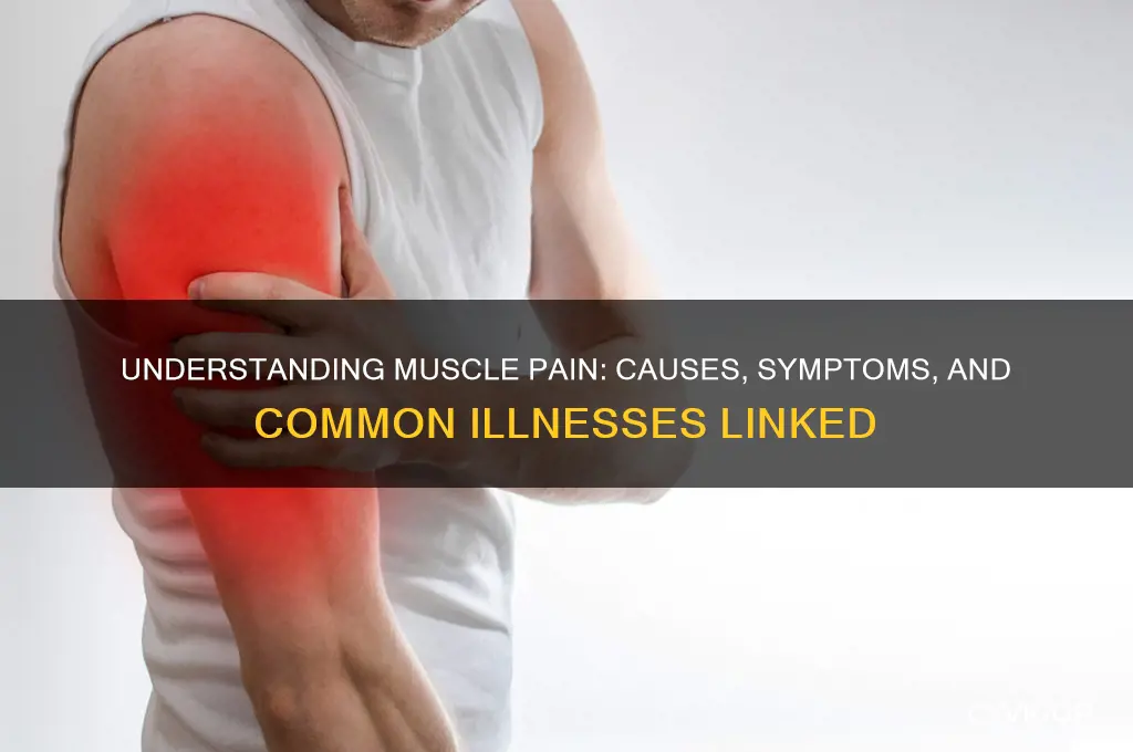 Understanding Muscle Pain: Causes, Symptoms, And Common Illnesses ...