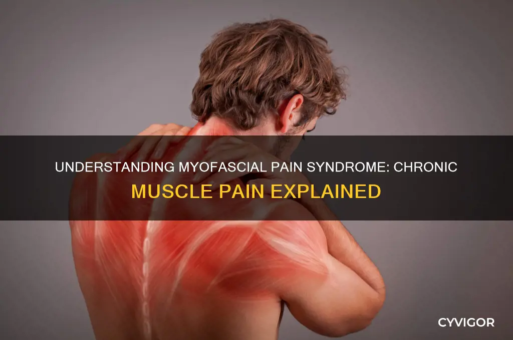 Understanding Myofascial Pain Syndrome: Chronic Muscle Pain Explained ...